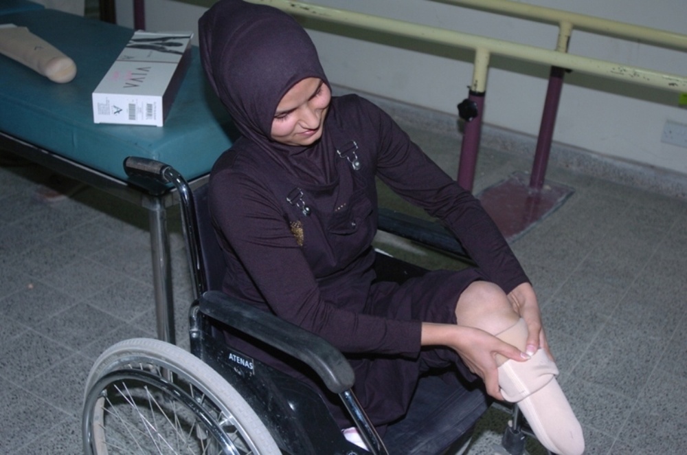 DVIDS - Images - Young girl fitted for prosthetic [Image 3 of 5]