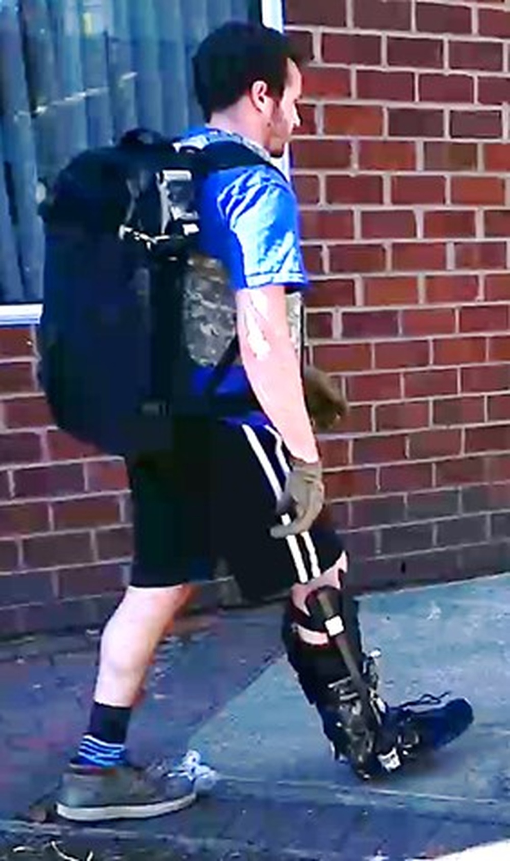 DVIDS - News - Spray Foam Cast Developed by USAMRDC Adopted for Rehabilitation Exoskeleton