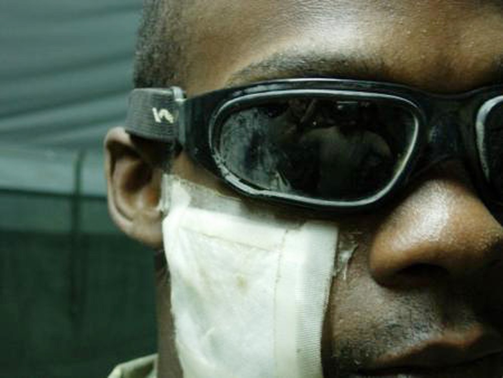 DVIDS - Images - Eye Protection Credited with Saving Soldier's Eye in Iraq