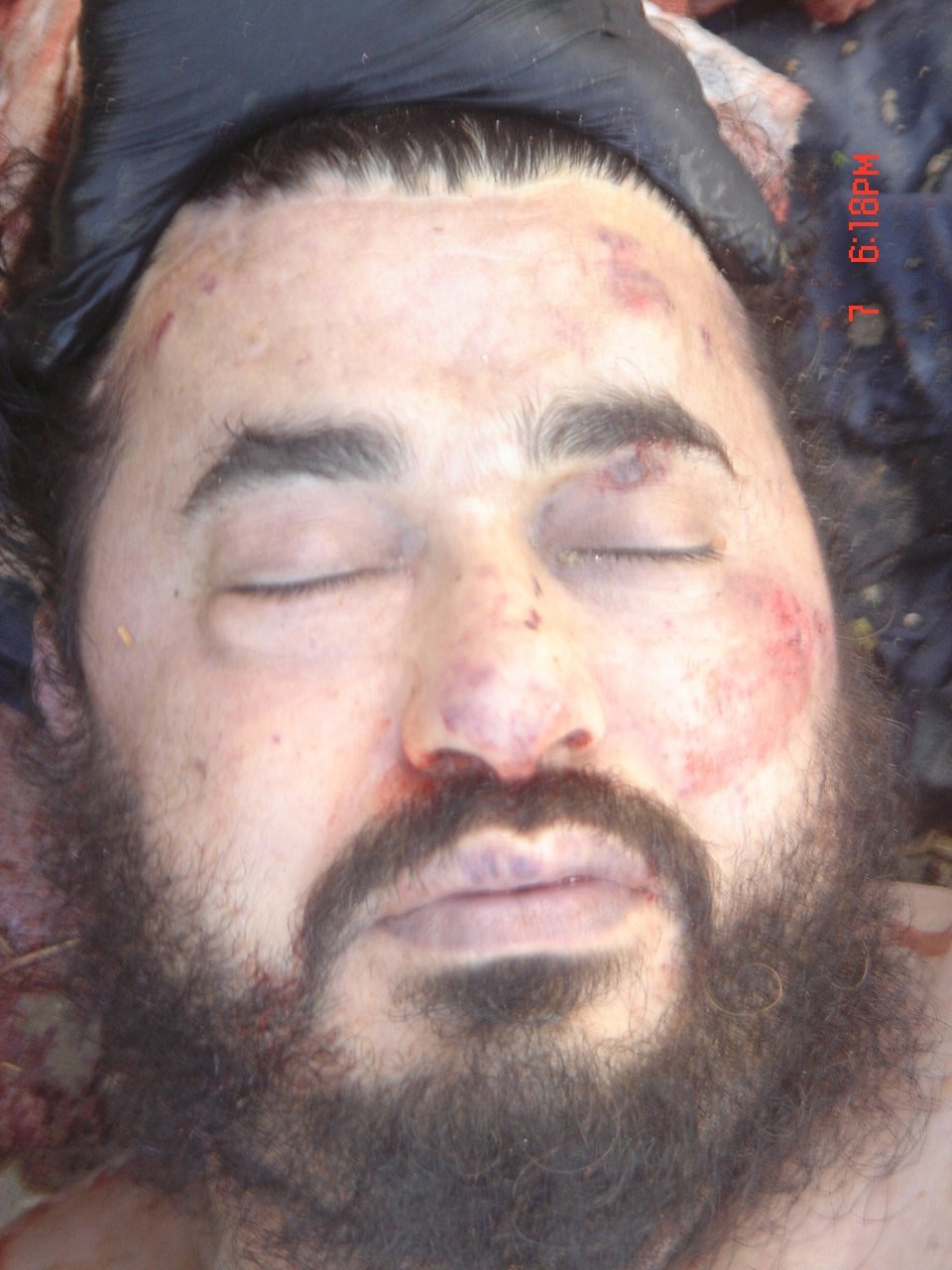 DVIDS - Images - The body of Abu Musab al-Zarqawi photographed after he ...